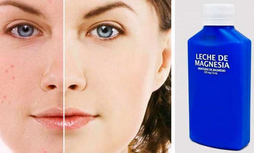 Descubre los 7 beneficios de la leche magnesia para tu piel ¡Por algo ...