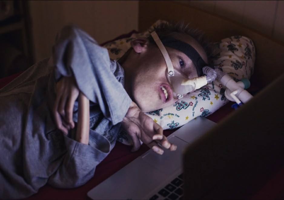 Torstein Lerhol, el hombre que pesa menos de 17 kilos y ha inspirado a ...