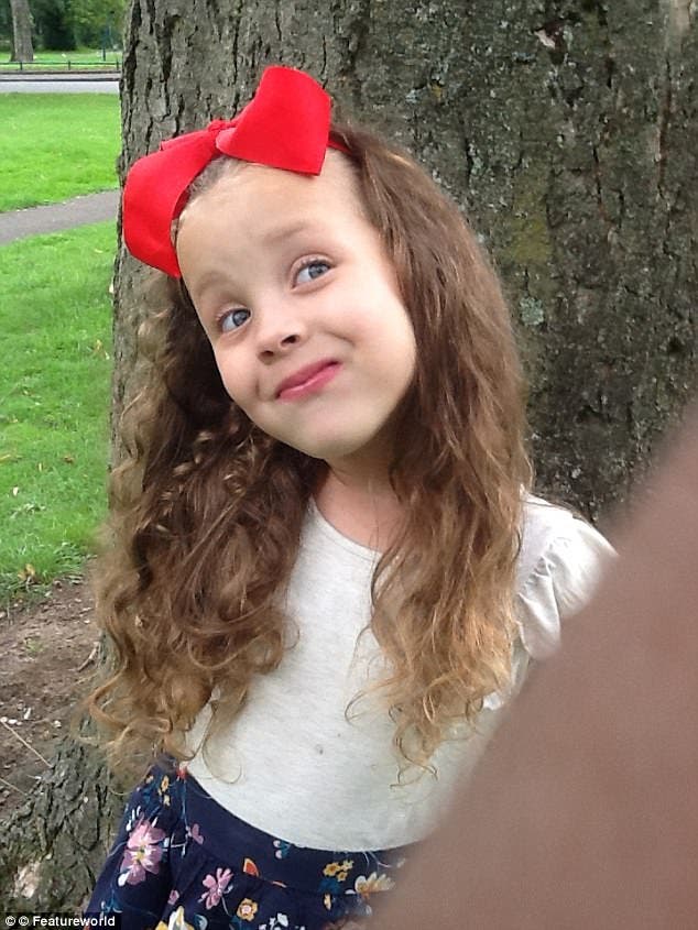 El Insólito Caso De Tiara La Bebé Que Nació Tan “diferente” Que Hasta