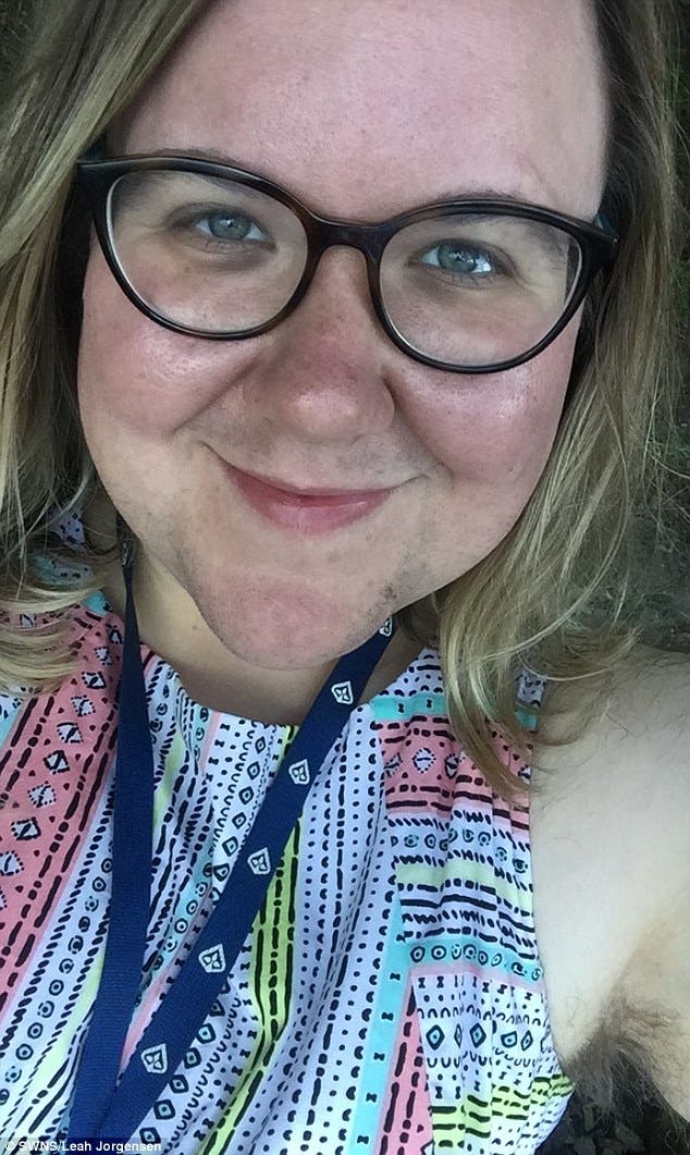 Un accidente la hace aceptar y amar su exceso de vello corporal a pesar de los señalamientos ...