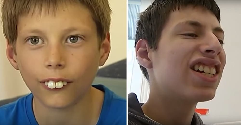 Tras 5 años de tratamientos renueva su sonrisa después de ser señalado ...