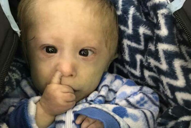 Los padres de un bebé con enanismo suplican ayuda para poder ofrecerle ...