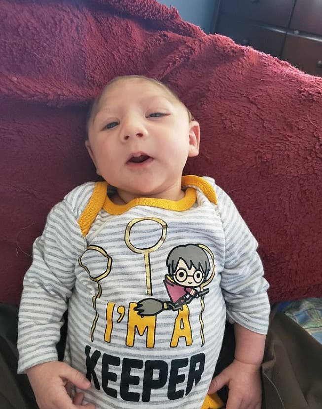 La madre de un bebé con microcefalia cuenta que su hermana "ve más allá ...