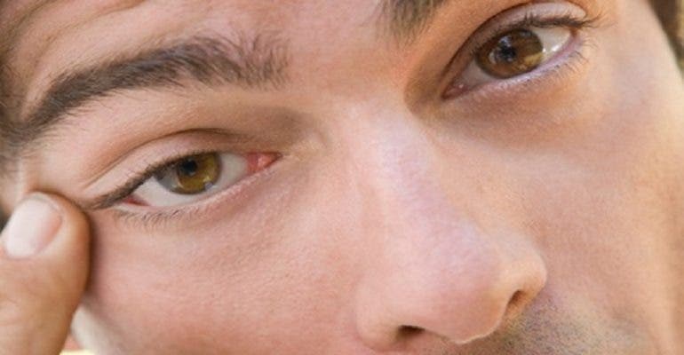 ¿Por qué nos tiembla el párpado del ojo? El cuerpo intenta decirnos ...