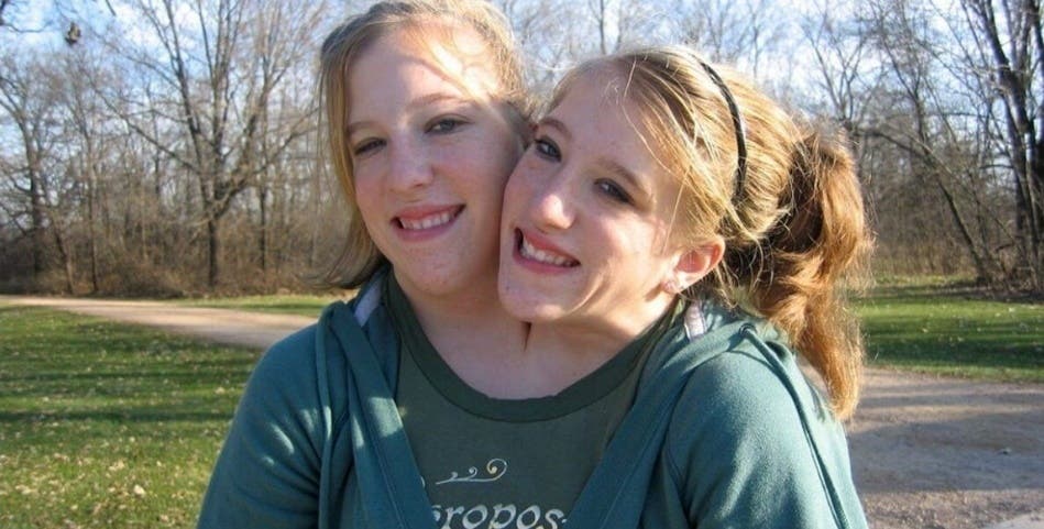 Las gemelas siamesas Abby y Brittany Hensel ya cumplieron 33 años, son ...